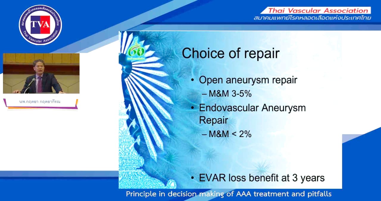 0502 - Principle in decision making of AAA treatment and pitfalls ...