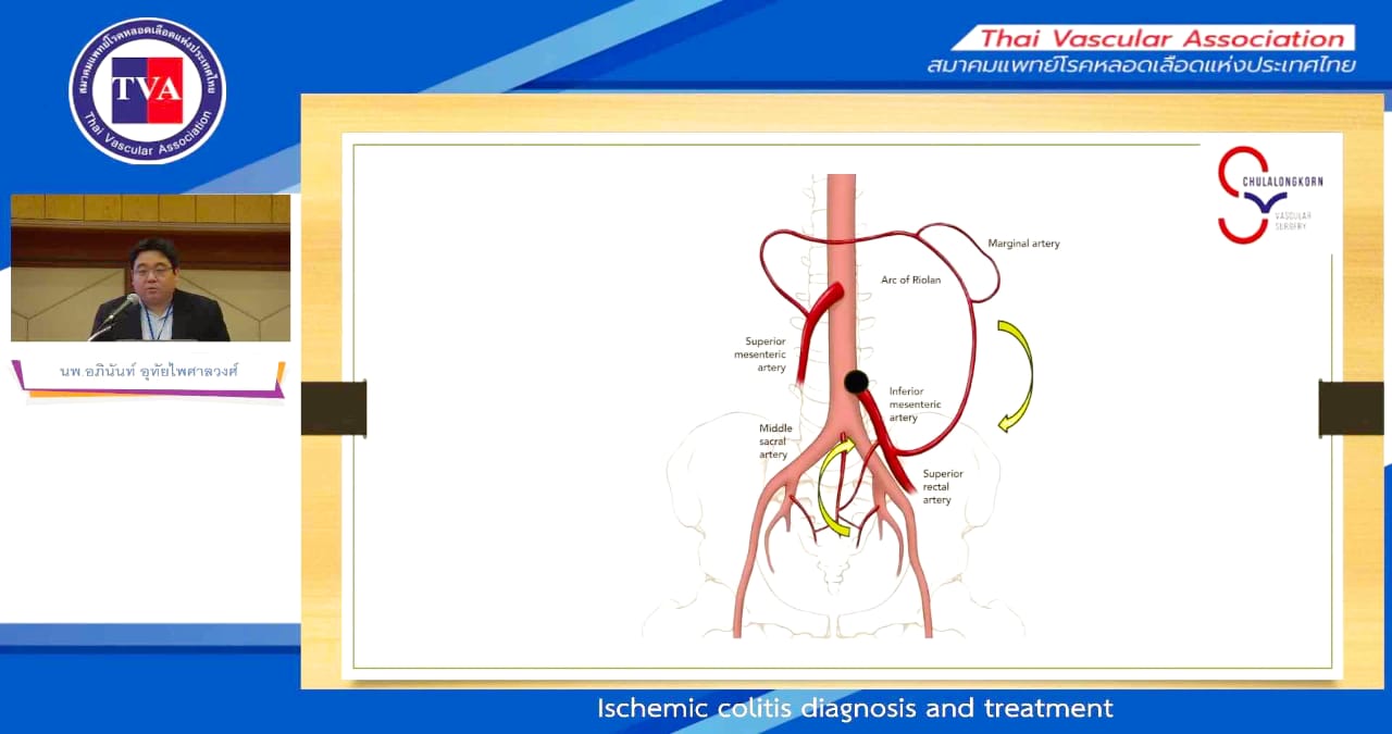0508 - Ischemic colitis diagnosis an treatment - สมาคมแพทย์โรคหลอดเลือด ...